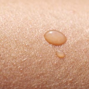Water drop on human skin - www.Stratamed.com